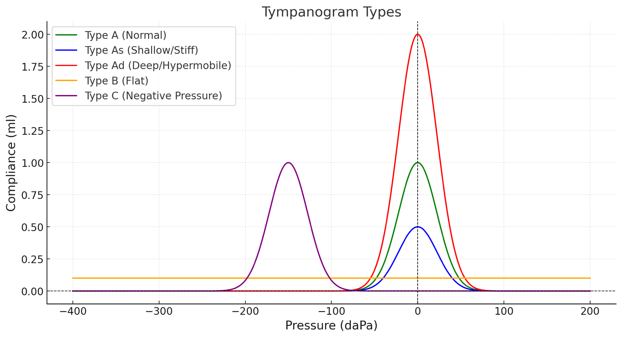 How to read Tympanogram December 2025